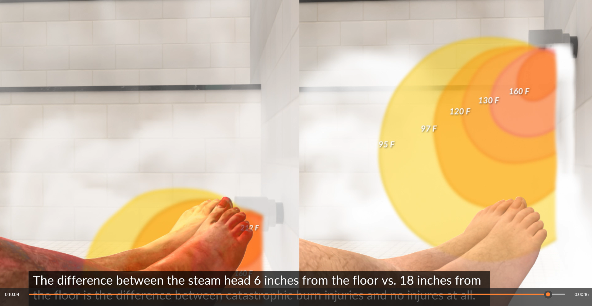 Burn Injuries Due to Negligence in Commercial Operations or Design Safety